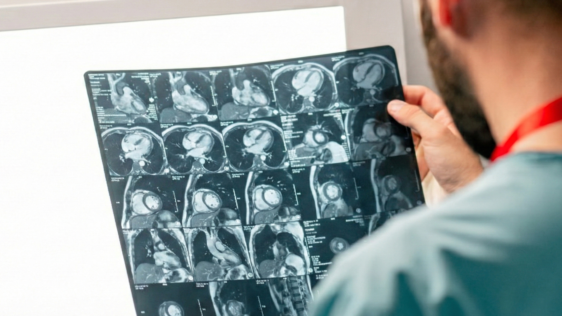 Smarter MRI image analysis for the whole heart - KAUST Discovery